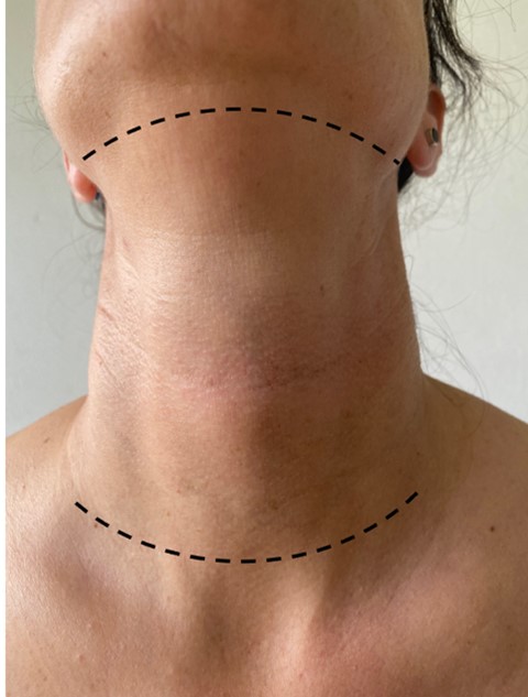 TEMA 1. CIRUGÍA MAXILOFACIAL