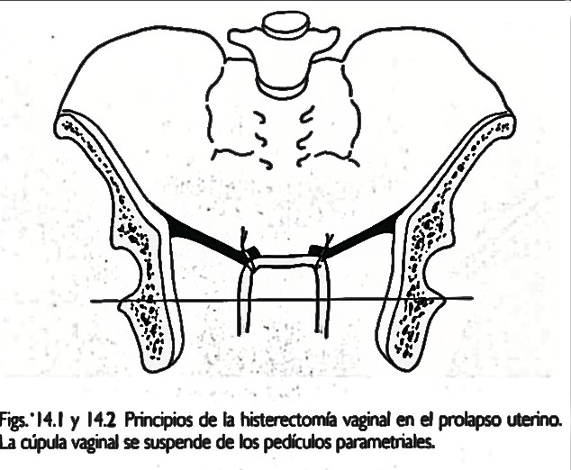 TEMA 6. CIRUGÍA GINECOLÓGICA Y OBSTÉTRICA