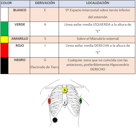 Tema 1 Monitorizaci n B sica En UCIN Y UCIP Tema 1 Monitorizaci n B sica En UCIN Y UCIP